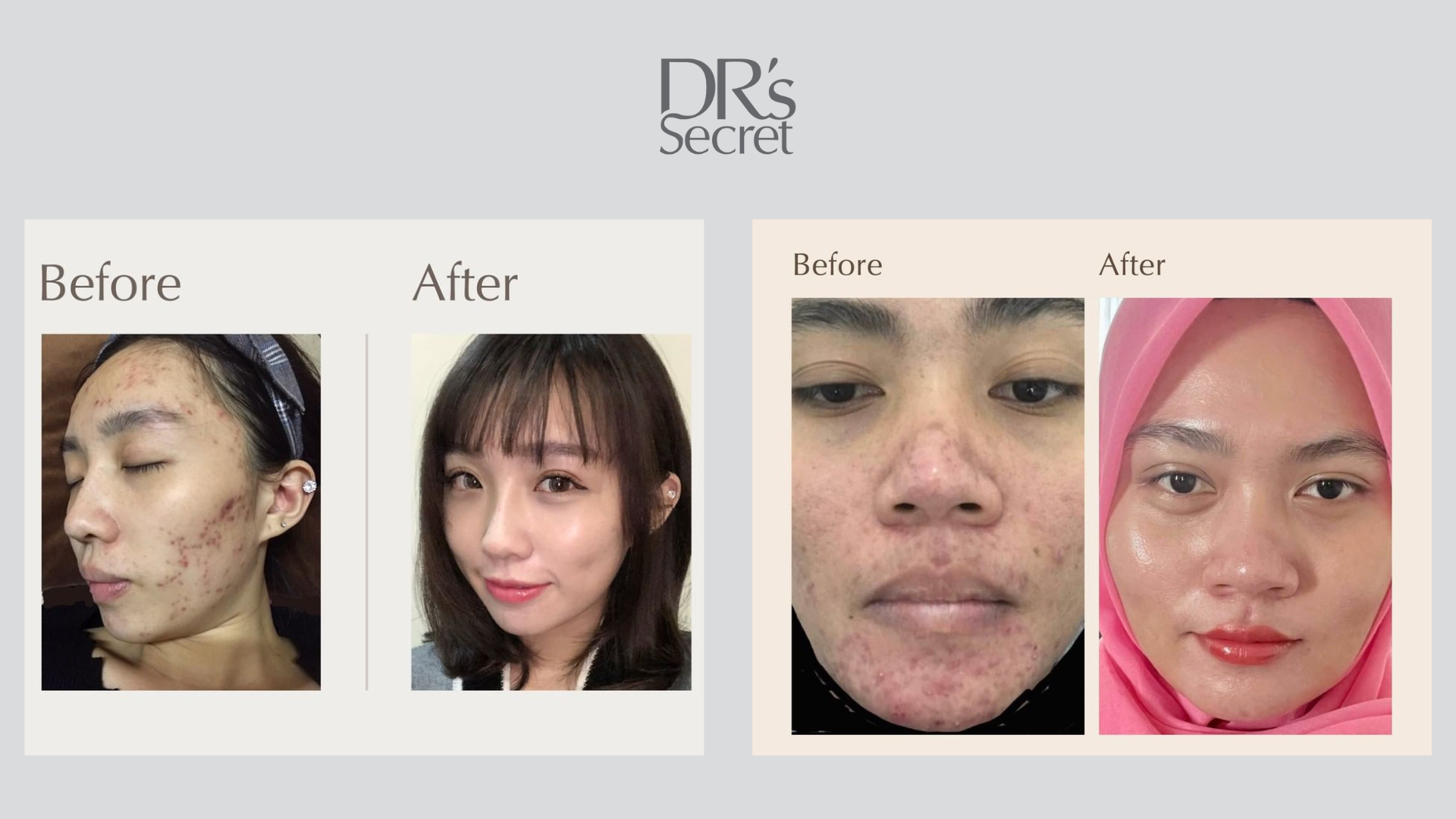 Produk DR Secret Face | Shopee Indonesia