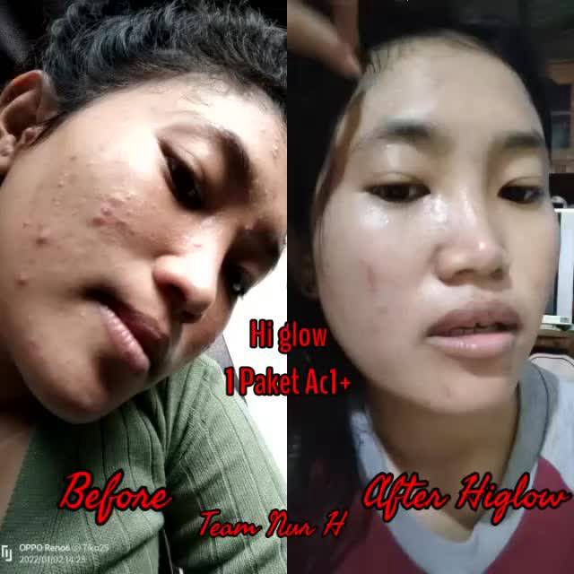 Produk HIGLOW SKINCARE ORIGINAL | Shopee Indonesia