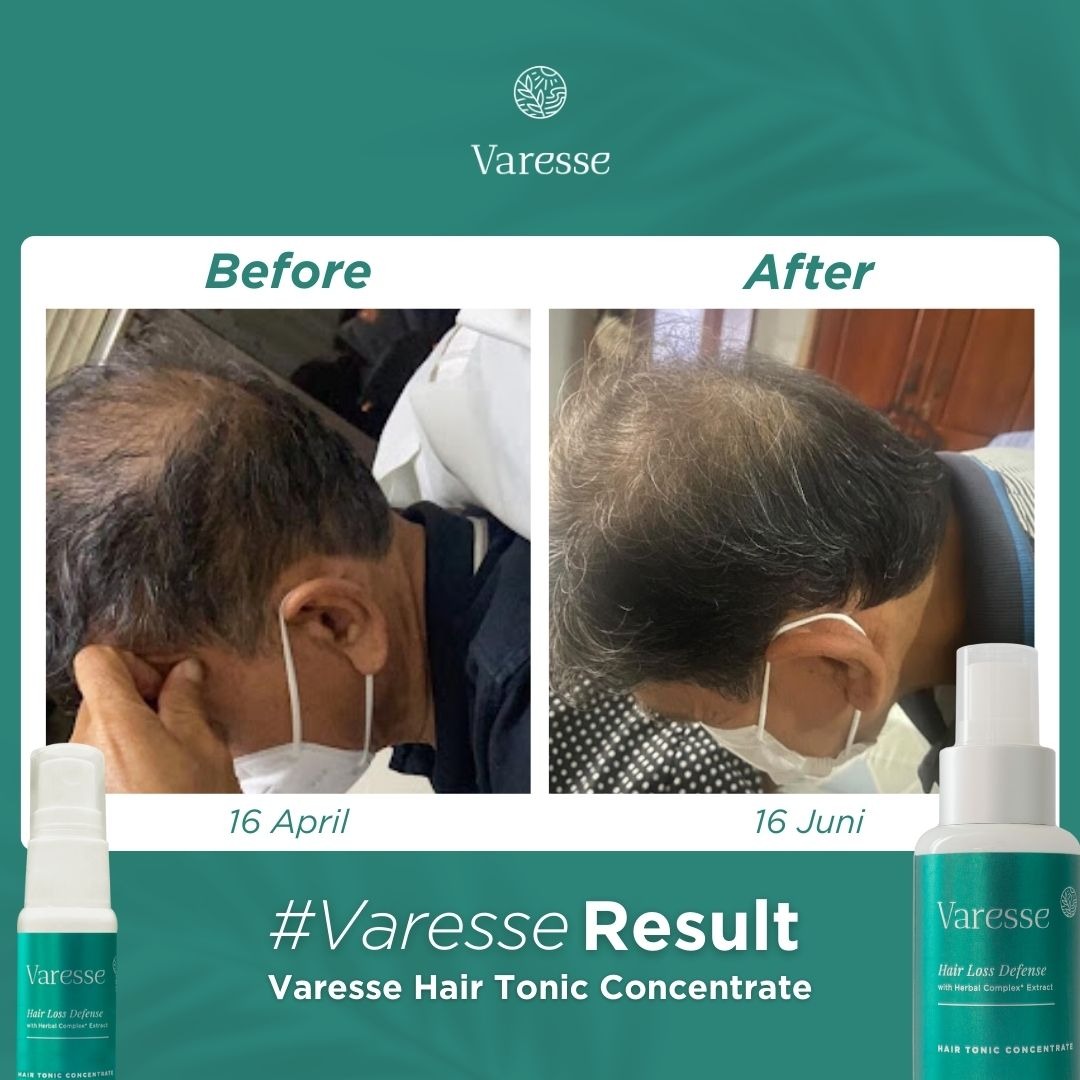 Toko Online Varesse Official Shop | Shopee Indonesia