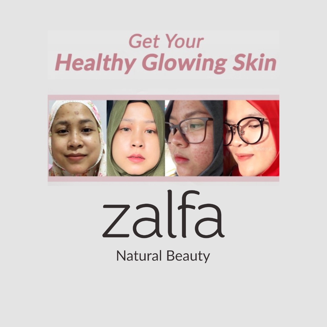 Toko Online Zalfa Natural Official Shop | Shopee Indonesia