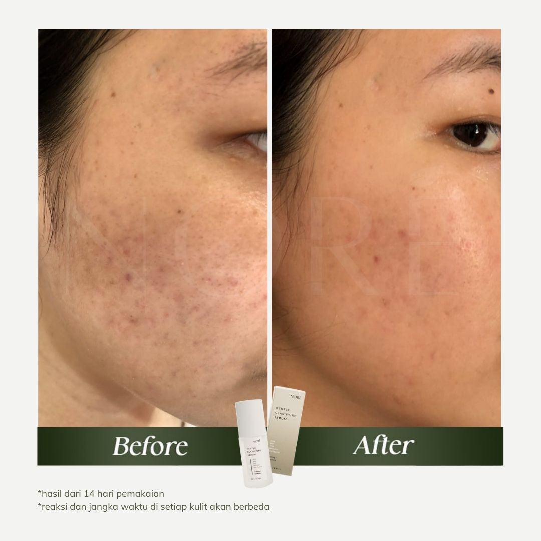 Produk NORE Official Shop | Shopee Indonesia