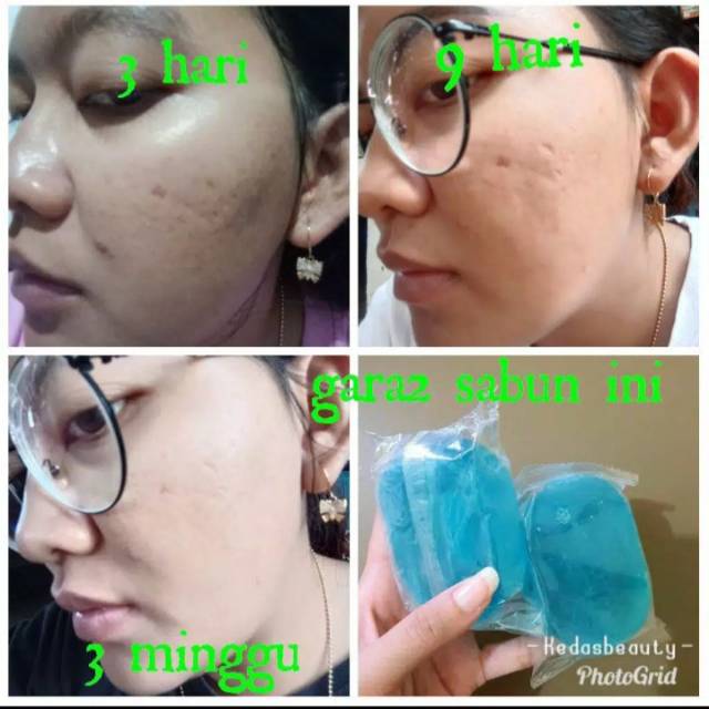 Produk Asty Beautycare | Shopee Indonesia