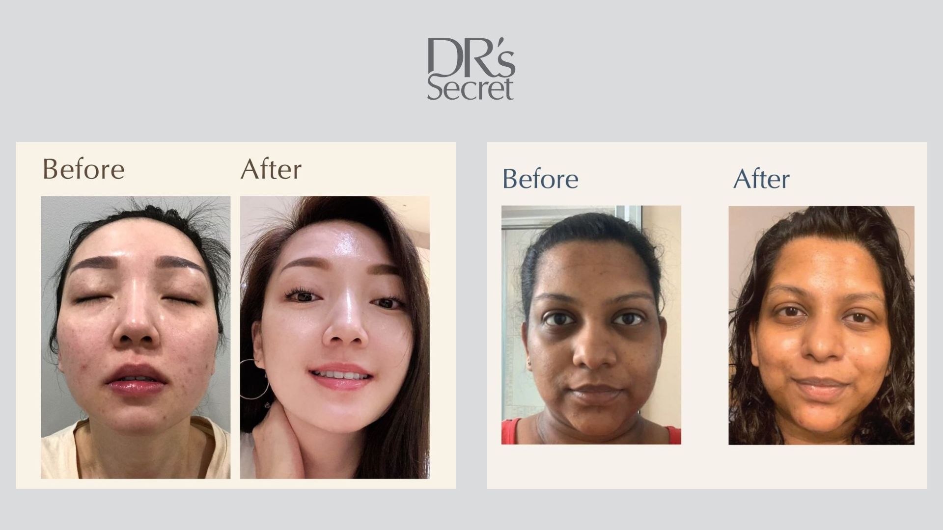 Produk DR Secret Face | Shopee Indonesia