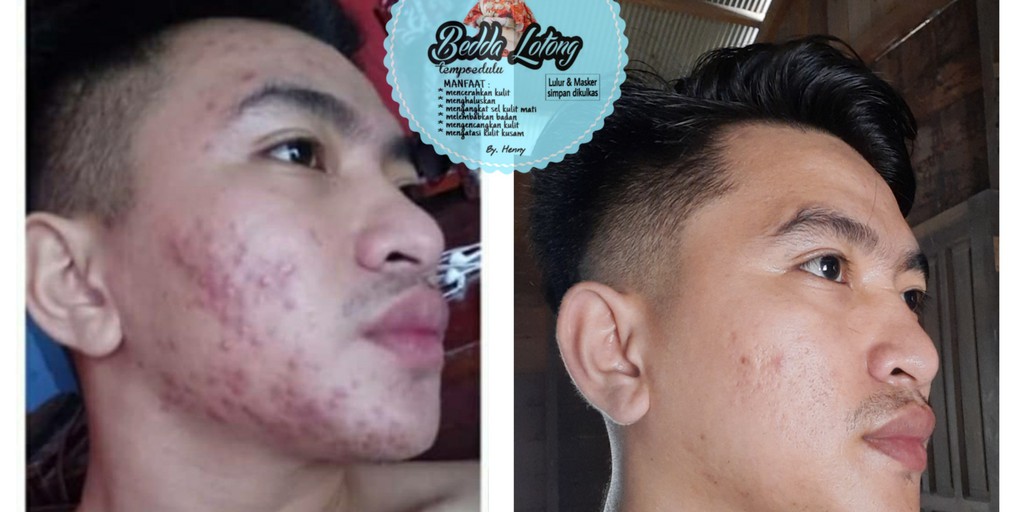 Produk Henny beautystore | Shopee Indonesia