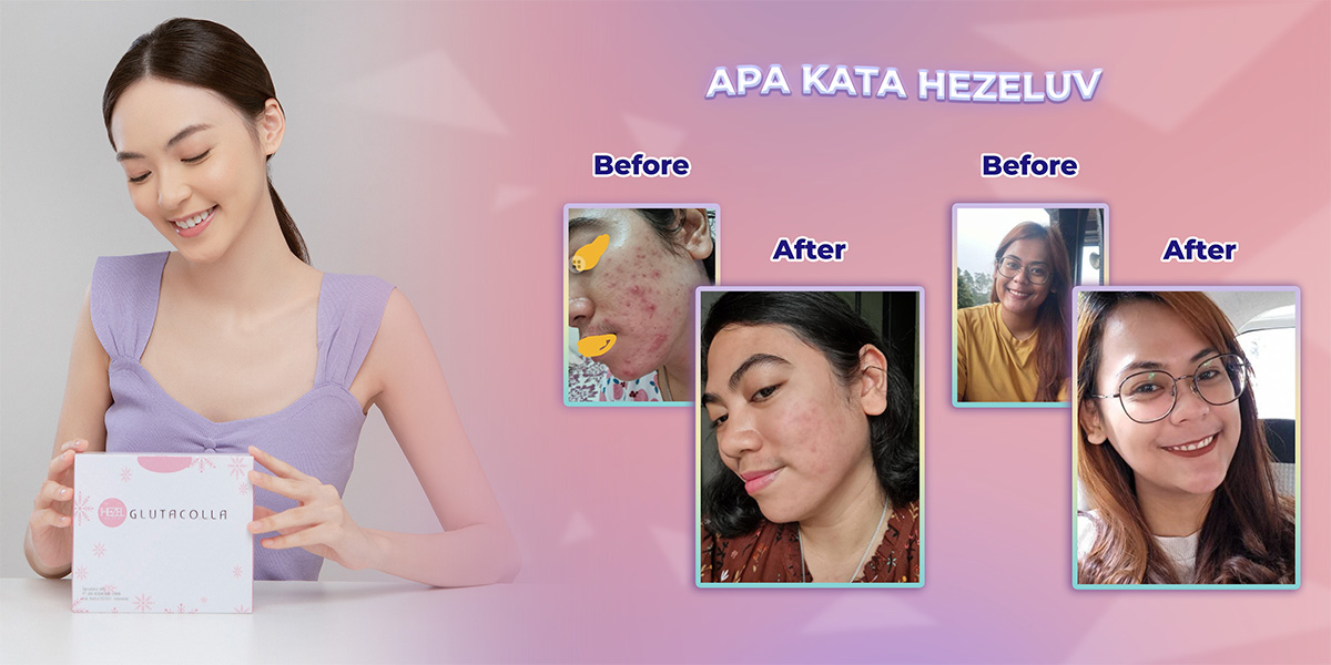 Toko Online Hezel Official Shop | Shopee Indonesia