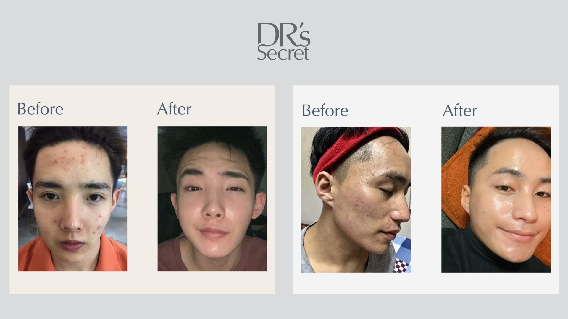 Produk DR Secret Face | Shopee Indonesia