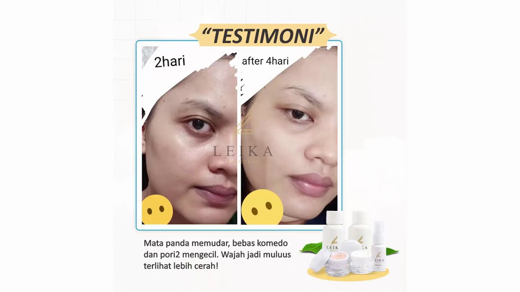 Produk Leika Beauty Skincare | Shopee Indonesia