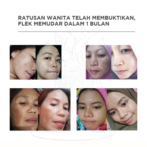 Toko Online Hiqween Skin Nutrition Official Shop | Shopee Indonesia