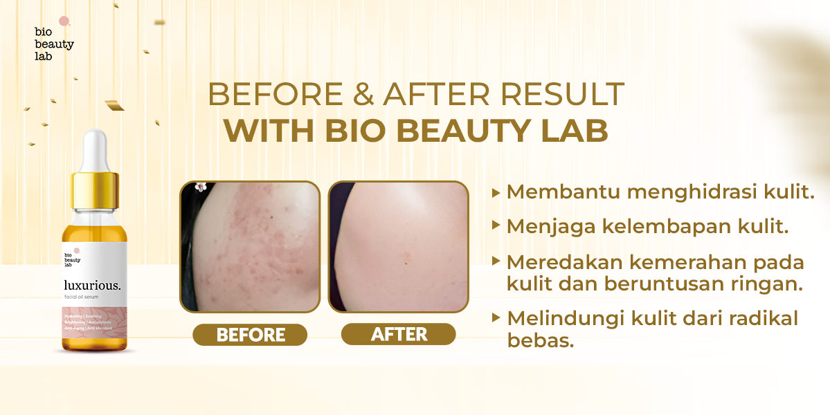 Toko Online Bio Beauty Lab Official Shop | Shopee Indonesia