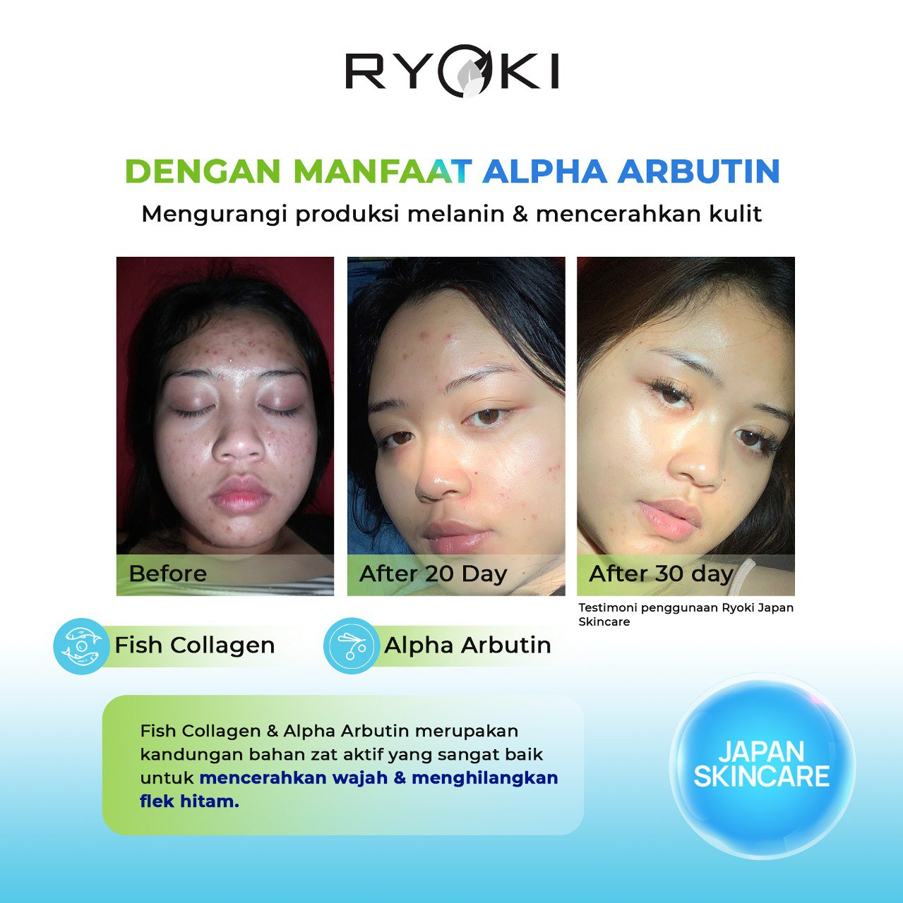 Produk Ryoki Official Japan Skincare | Shopee Indonesia