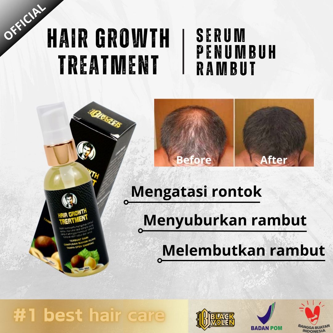 Produk MINYAK PENUMBUH RAMBUT | Shopee Indonesia